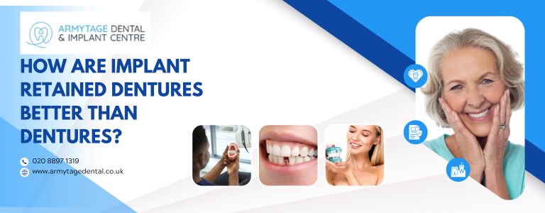 Your Guide to Implant Retained Dentures | Armytage Dental